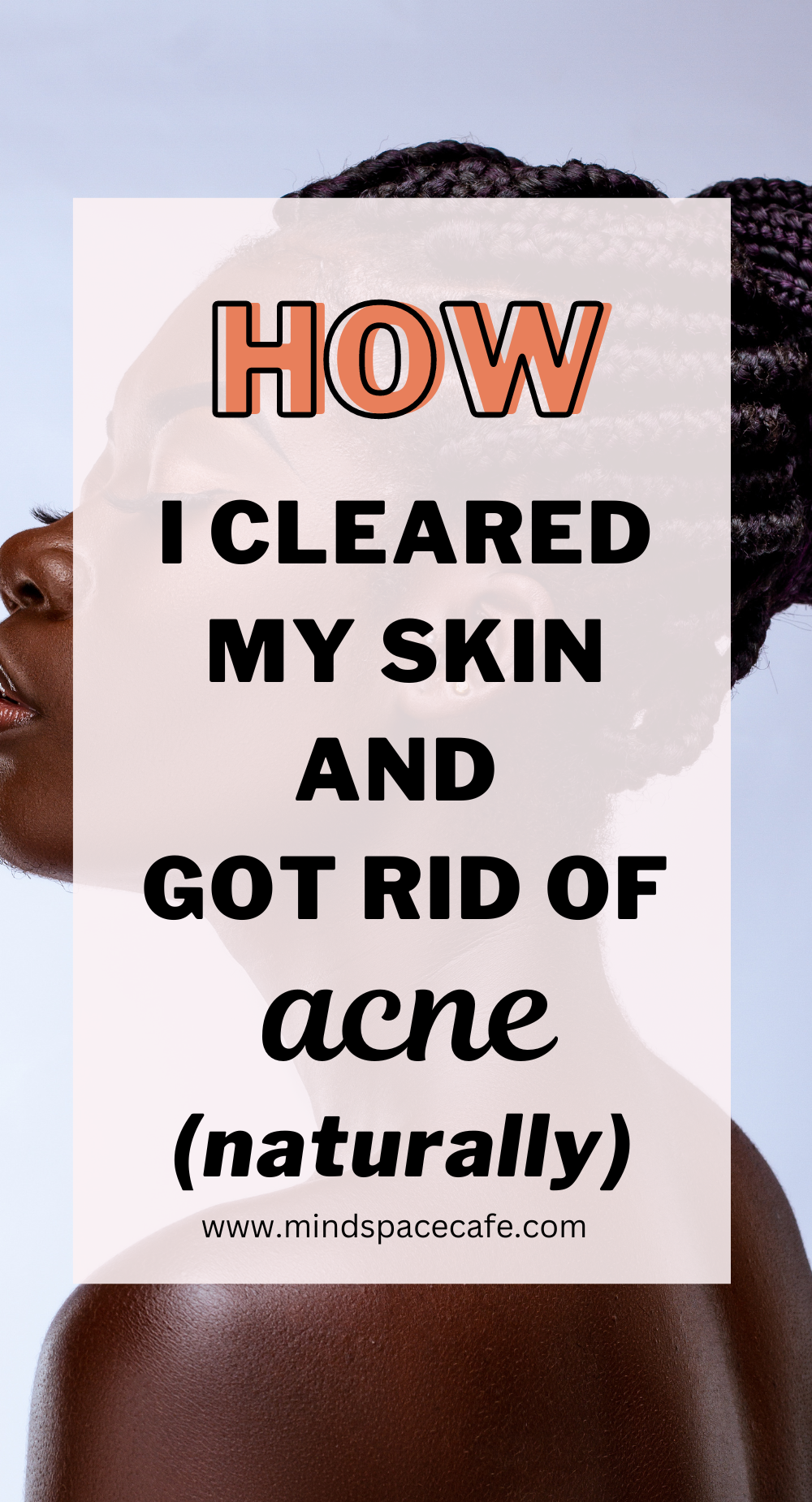 How I Got Rid of Acne Hyperpigmentation and Dark Spots in 10 Weeks(Dark ...