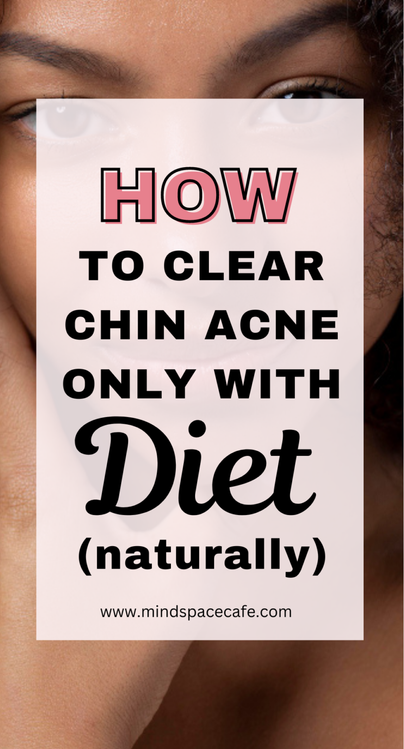 9 Foods that Cleared My Stubborn Chin Acne for Good (Hormonal Acne Diet ...