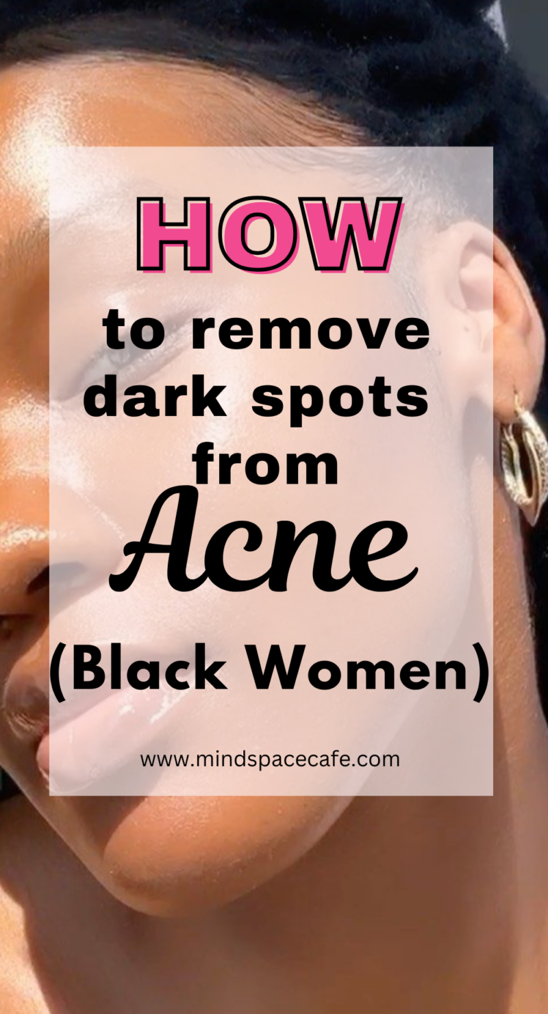 How I Got Rid of Acne Hyperpigmentation and Dark Spots in 10 Weeks(Dark ...