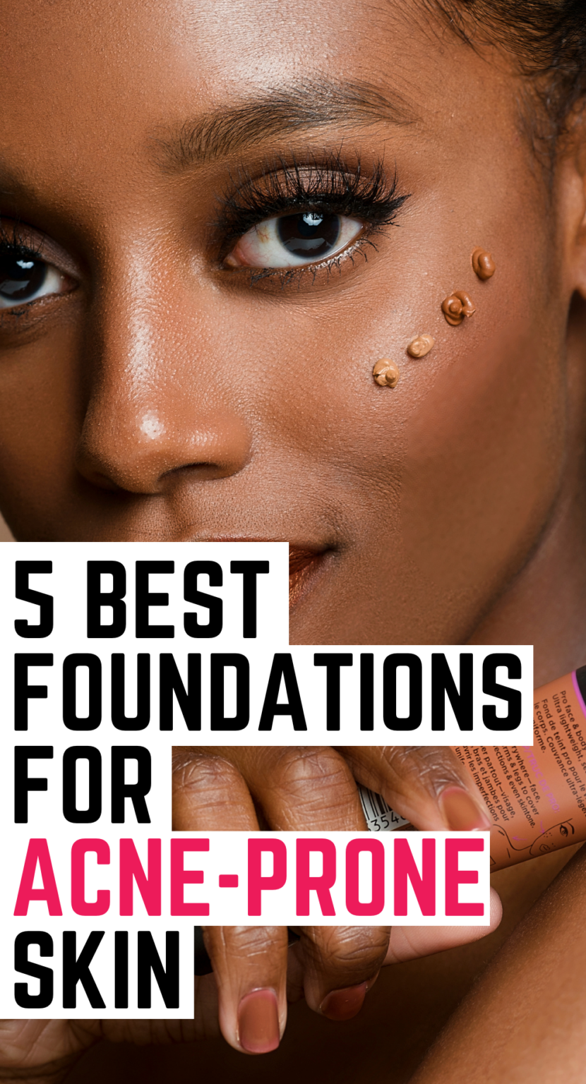 5 Best Foundations for Acne-Prone Skin [Tried and Tested]